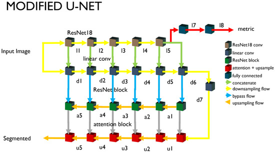 Enhanced WGAN Model for Diagnosing Laryngeal Carcinoma