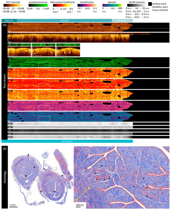 Multimodal Optical Imaging of Ex Vivo Fallopian Tubes to Distinguish ...