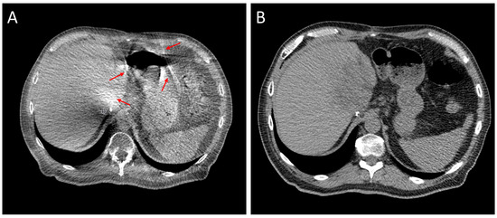 Daily Diagnostic Quality Computed Tomography-on-Rails (CTOR) Image ...