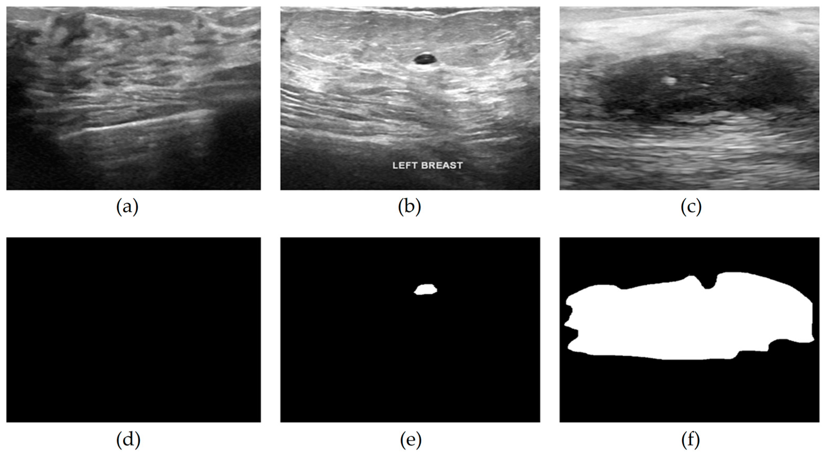UCapsNet: A Two-Stage Deep Learning Model Using U-Net and Capsule ...