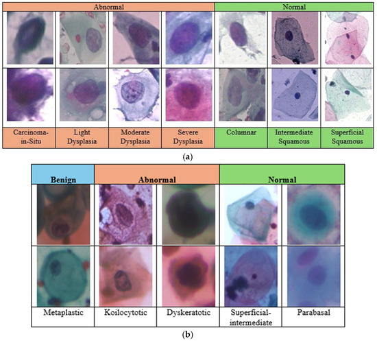 Novelty Classification Model Use in Reinforcement Learning for Cervical Cancer