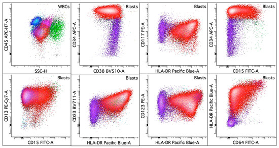 Acute Myeloid Leukemia: Diagnosis and Evaluation by Flow Cytometry
