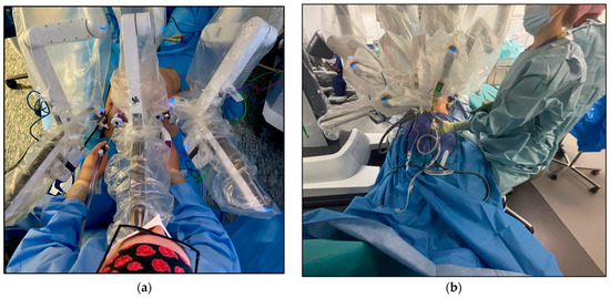 Surgical Technique and Perioperative Outcomes of the “Sapienza” Urology ...