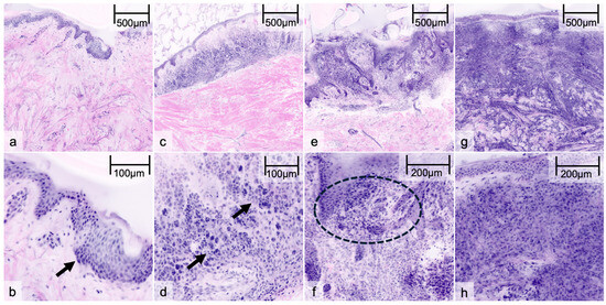 Benign or Malignant? Ex Vivo Confocal Laser Scanning Microscopy for Bedside Histological ...
