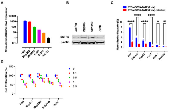 SSTR2-Targeted Theranostics in Hepatocellular Carcinoma