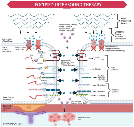 Deciphering the Blood–Brain Barrier Paradox in Brain Metastasis ...