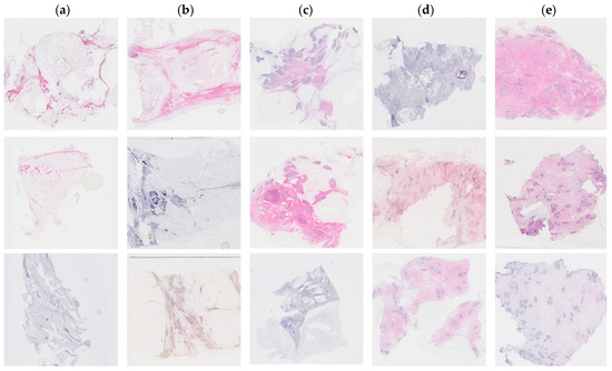 A Deep Learning Approach for the Classification of Fibroglandular ...