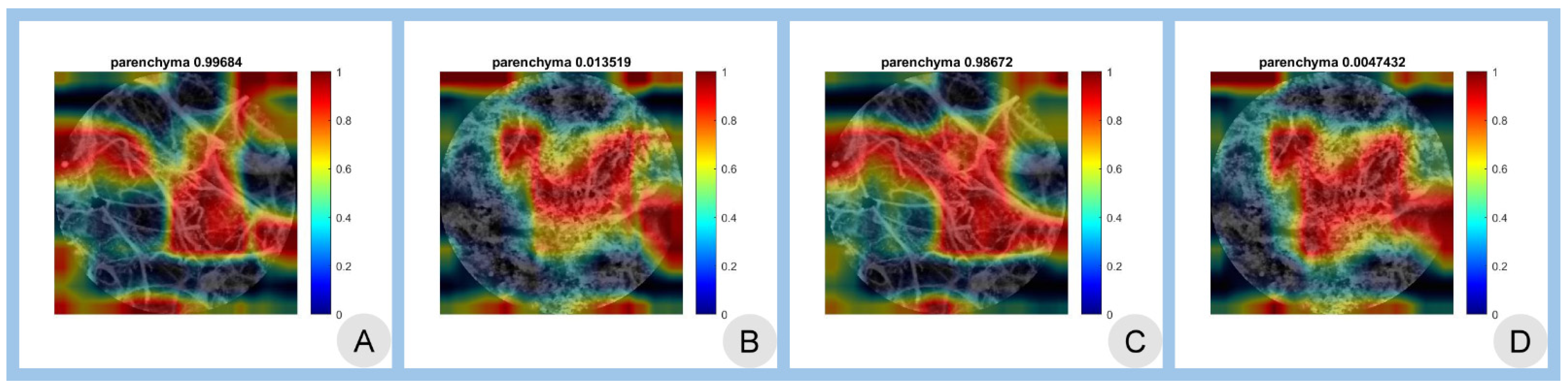 Transfer Learning-Based Integration of Dual Imaging Modalities for ...