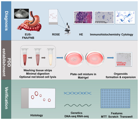 Establishing Pancreatic Cancer Organoids from EUS-Guided Fine-Needle ...