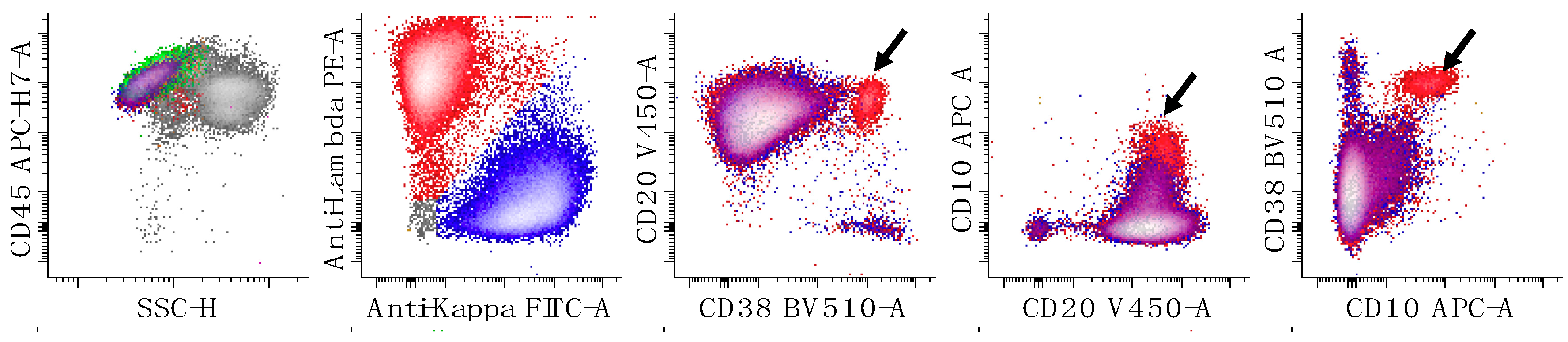 Flow Cytometry for B-Cell Non-Hodgkin and Hodgkin Lymphomas