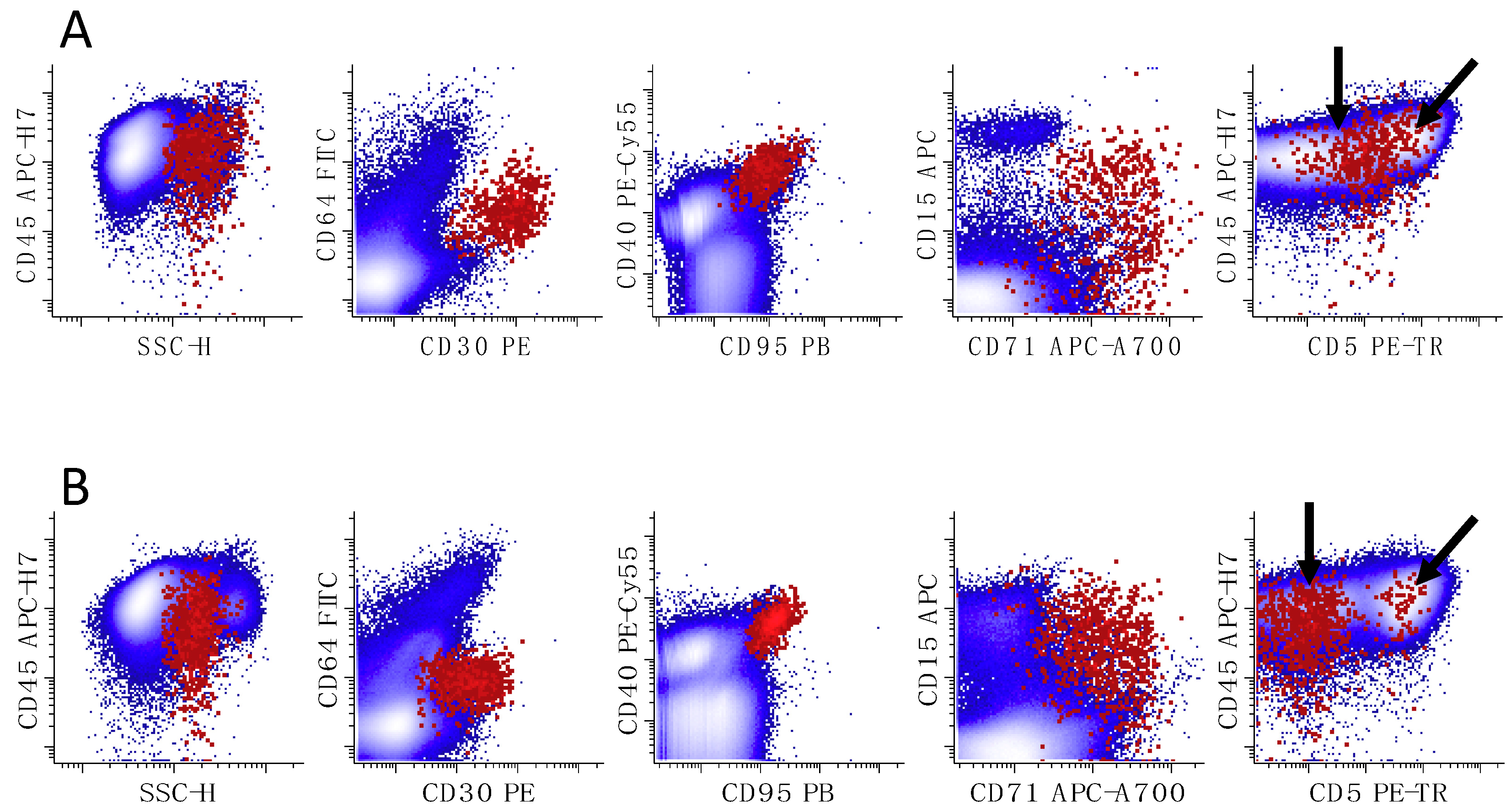 Flow Cytometry for B-Cell Non-Hodgkin and Hodgkin Lymphomas