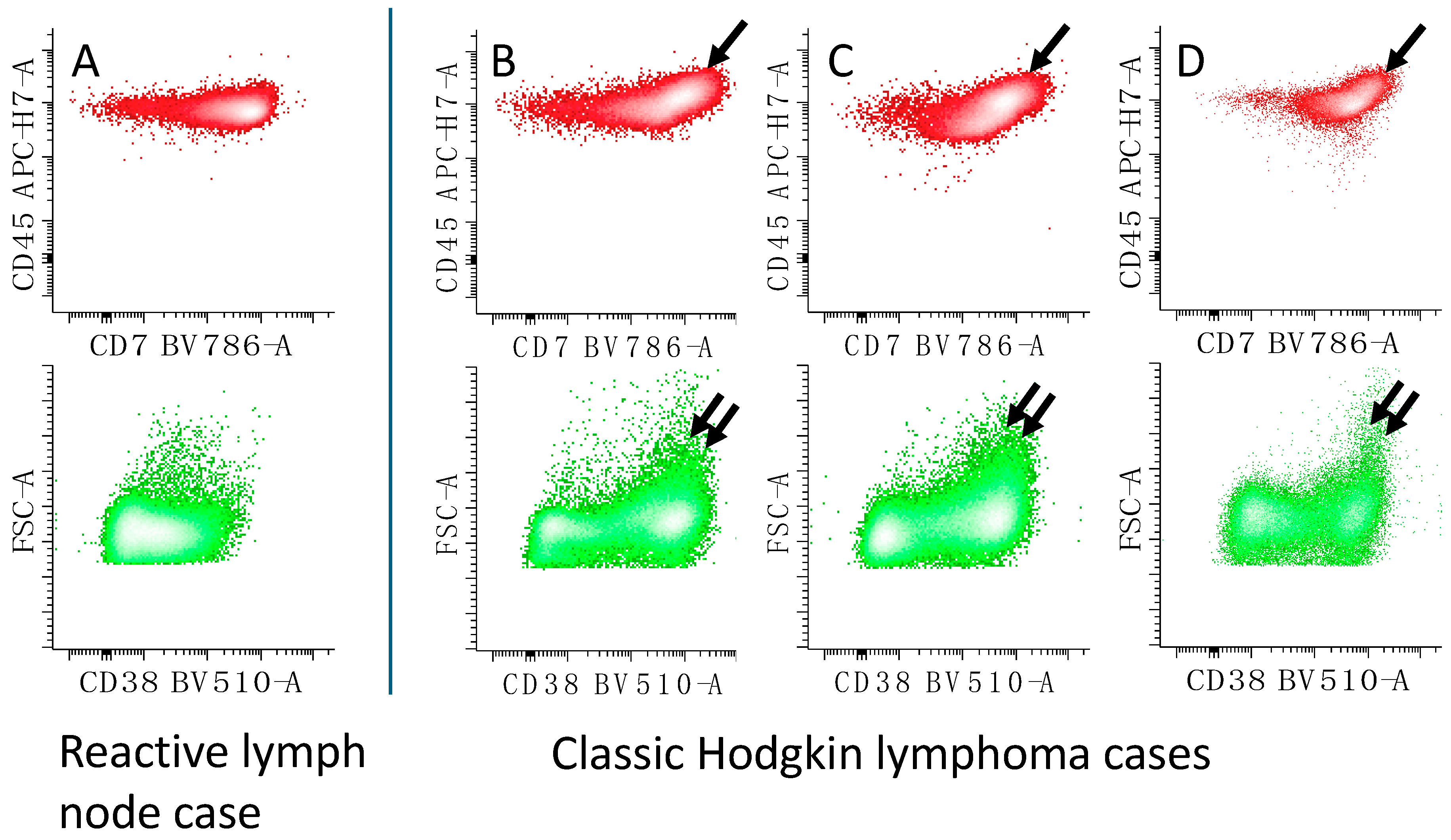 Flow Cytometry for B-Cell Non-Hodgkin and Hodgkin Lymphomas