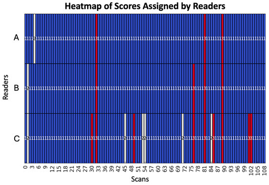 The Use of PI-FAB Score in Evaluating mpMRI After Focal Ablation of ...