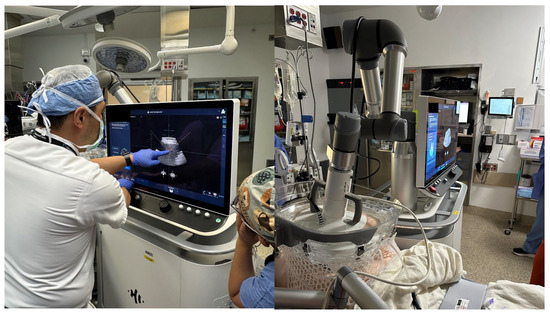 Histotripsy of Liver Tumors: Patient Selection, Ethical Discussions ...