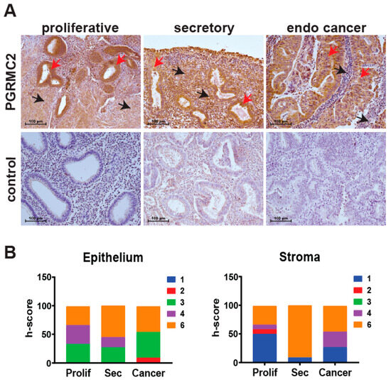 Uterine Pgrmc2 Deficiency Attenuates Endometrial Hyperplasia and Cancer ...