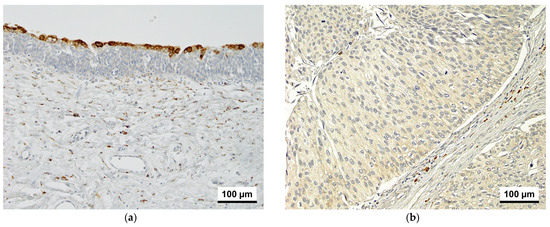 Association Between CKAP4 Expression and Poor Prognosis in Patients ...