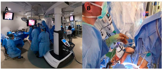 Combined TaTME with SP Robot for Low Anterior Resection in Rectal Cancer: rSPa TaTME