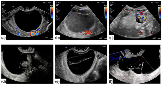 The Clinical Relevance of Distinguishing Between Simple and Complex ...