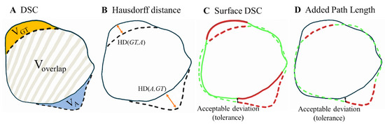 Deep Learning for Automated Ventricle and Periventricular Space ...