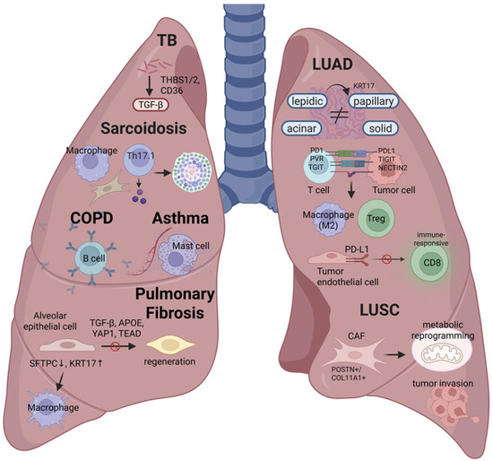 Spatial Transcriptomics in Lung Cancer and Pulmonary Diseases: A ...
