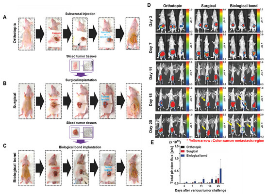 Establishment of an Orthotopic and Metastatic Colorectal Cancer Mouse ...