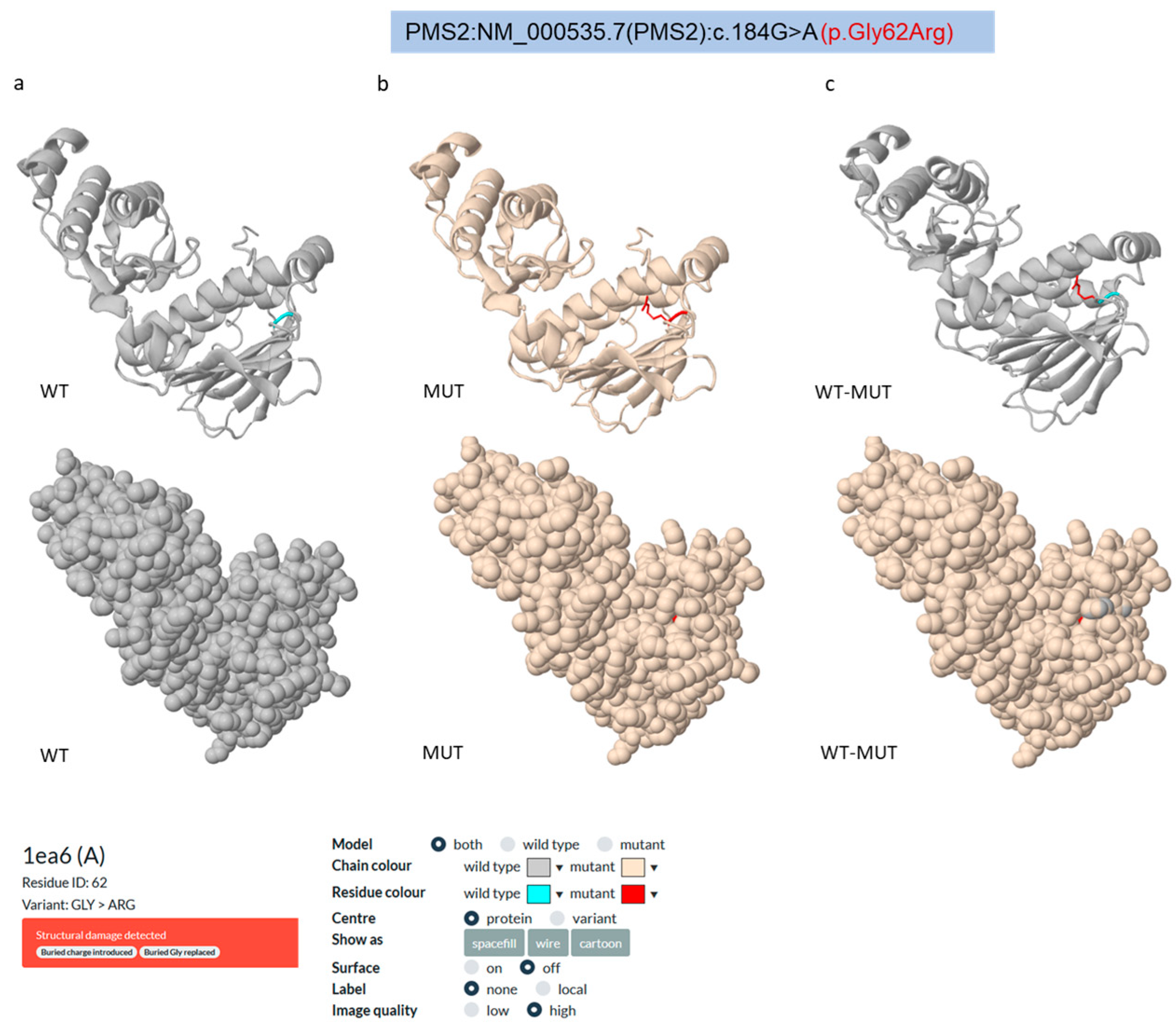 An Integrated Clinical, Germline, Somatic, and In Silico Approach to ...