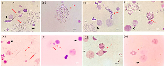 Unclassified Chromosomal Abnormalities as an Indicator of Genomic ...