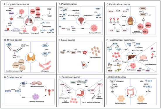 Regulators of Cancer Progression: Succinylation
