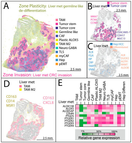 Spatial Transcriptomics Reveals Distinct Architectures but Shared ...