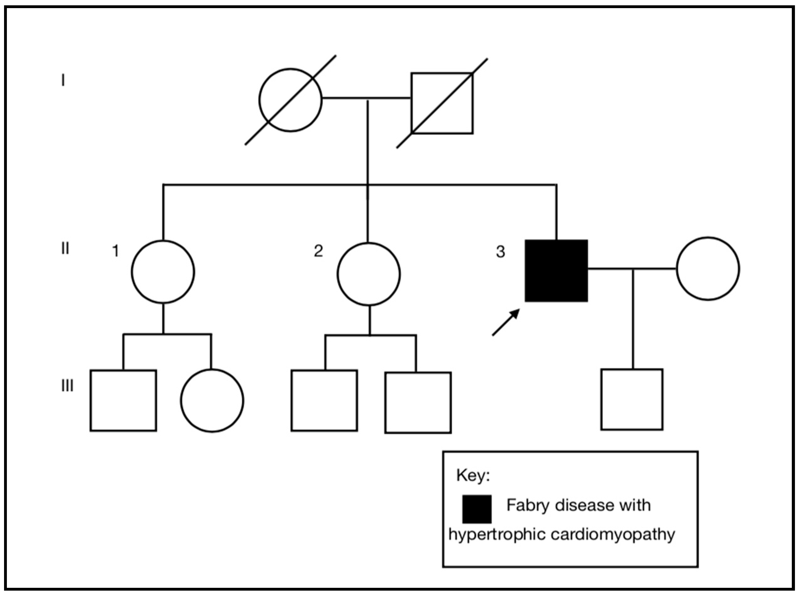 Mosaic Fabry Disease in a Male Presenting as Hypertrophic Cardiomyopathy