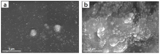Nanoparticle–Hydrogel Based Sensors: Synthesis and Applications