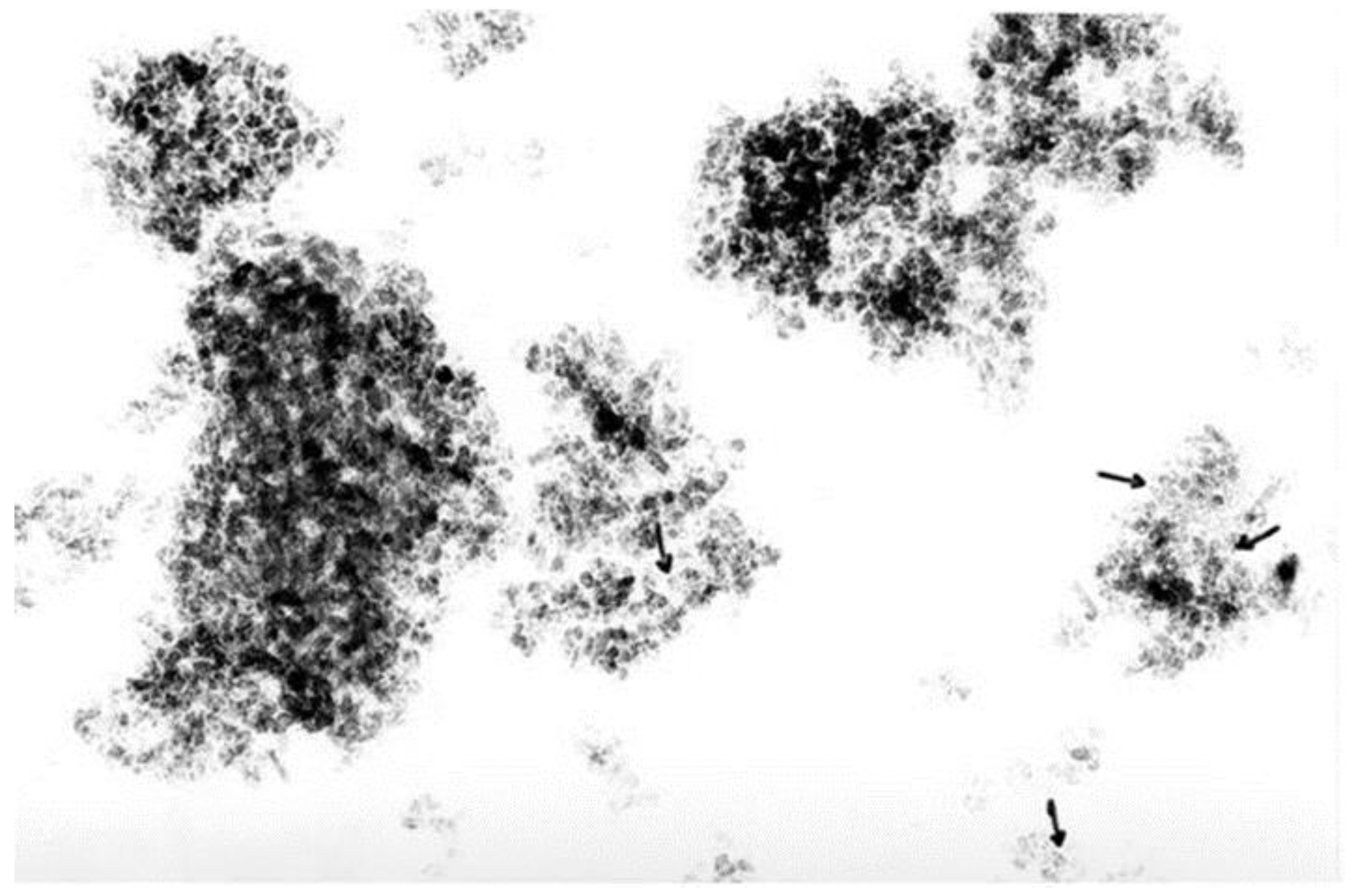 Performance of Modified Alumina-Supported Ruthenium Catalysts in the ...