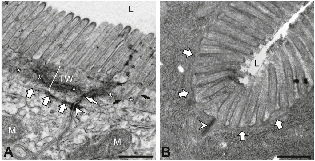 Intermediate Filaments and Polarization in the Intestinal Epithelium