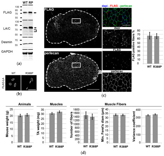 Distinct Fiber Type Signature in Mouse Muscles Expressing a Mutant ...