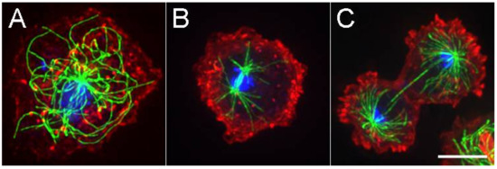 Cells | Free Full-Text | Centrosome Positioning in Dictyostelium ...