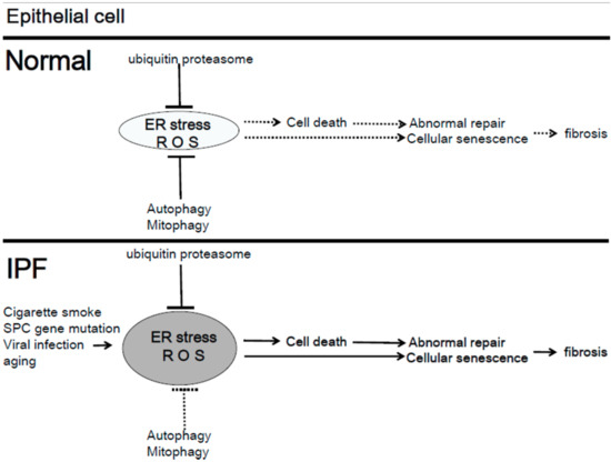 Mitochondrial Quality Control in COPD and IPF
