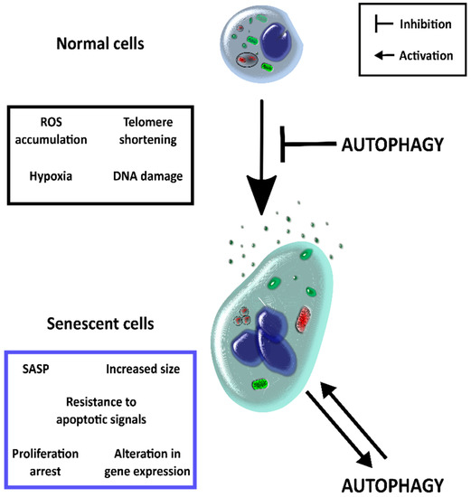 Cells | Special Issue : Autophagy in Age-Related Human Diseases