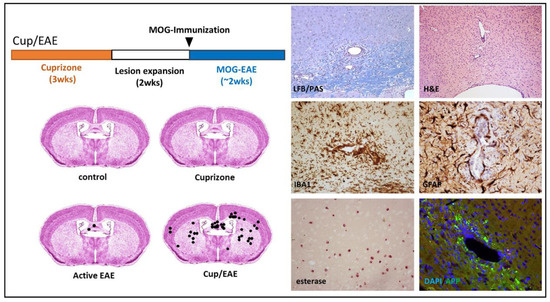 Mechanism of Siponimod: Anti-Inflammatory and Neuroprotective Mode of ...