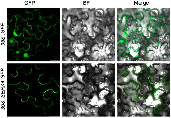 Cells | Free Full-Text | Characterization of Somatic Embryogenesis ...