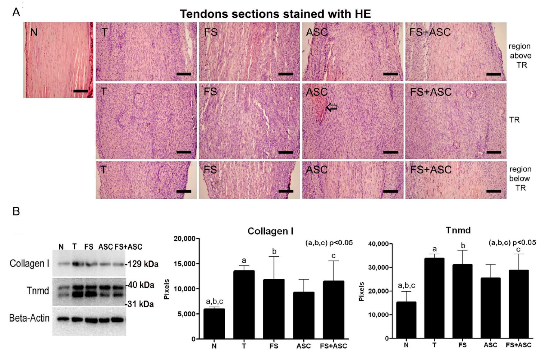 Transected Tendon Treated with a New Fibrin Sealant Alone or Associated ...