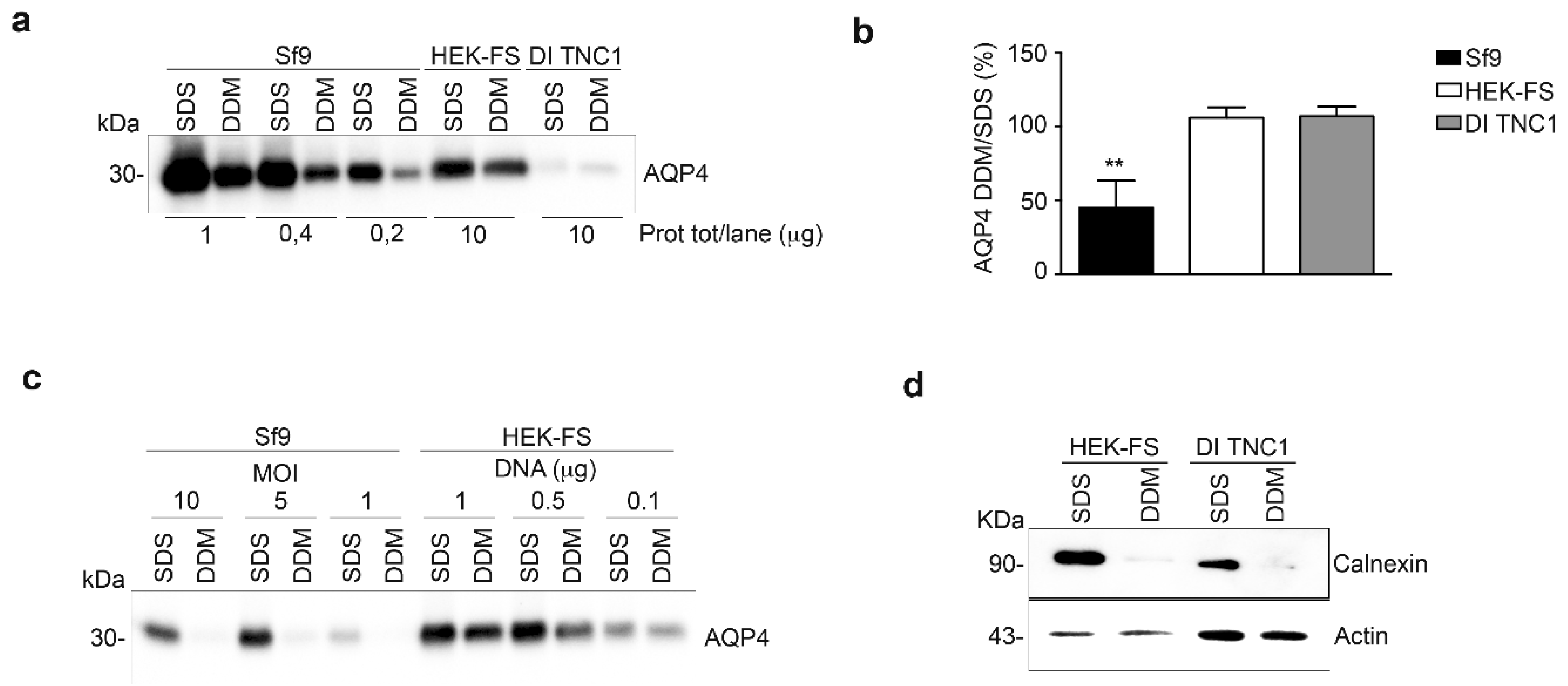 Host-Cell Type Dependent Features of Recombinant Human Aquaporin-4 ...