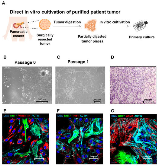 Systematic Generation of Patient-Derived Tumor Models in Pancreatic Cancer