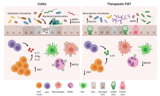 Cells | Free Full-Text | Fecal Microbiota Transplantation Controls ...