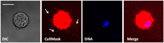 Insights on CTC Biology and Clinical Impact Emerging from Advances in ...