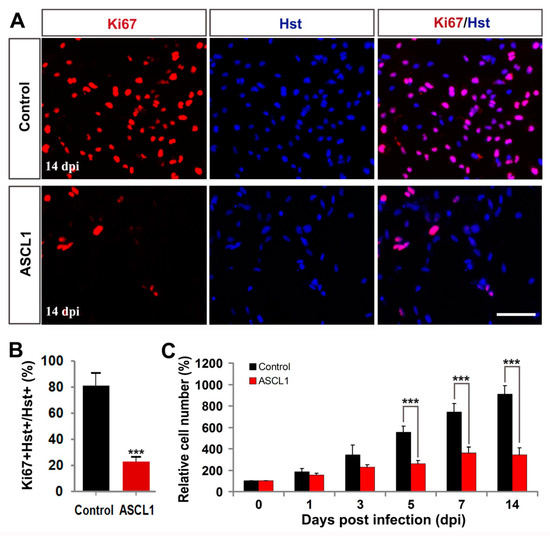 Inhibition of Glioma Development by ASCL1-Mediated Direct Neuronal ...