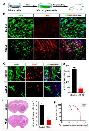 Inhibition of Glioma Development by ASCL1-Mediated Direct Neuronal ...