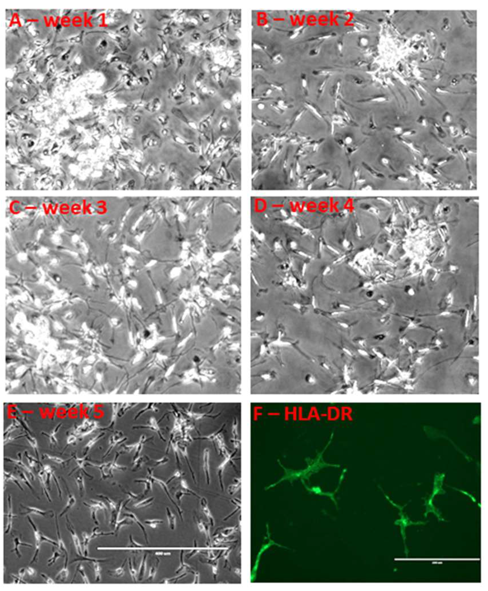 Cells | Free Full-Text | Alzheimer’s Disease Research Using Human Microglia