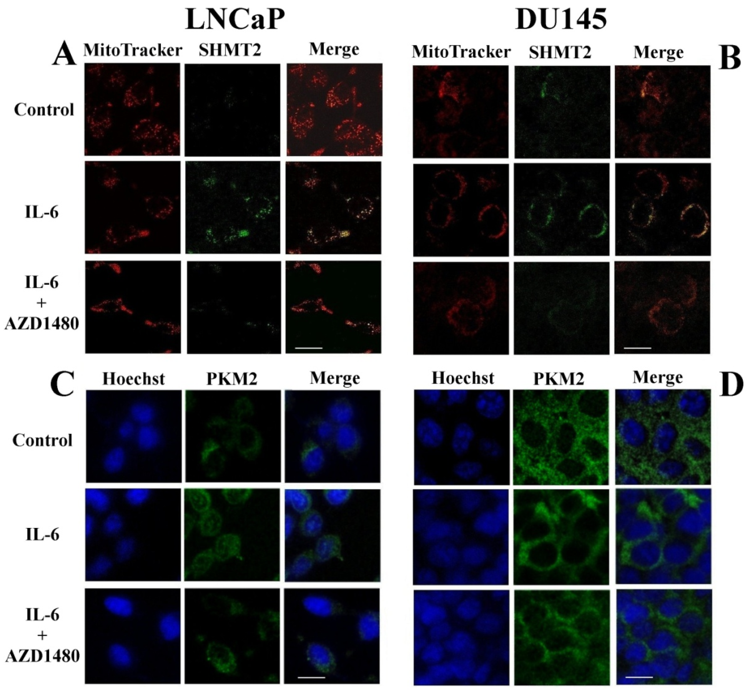 Shmt2: A Stat3 Signaling New Player in Prostate Cancer Energy Metabolism