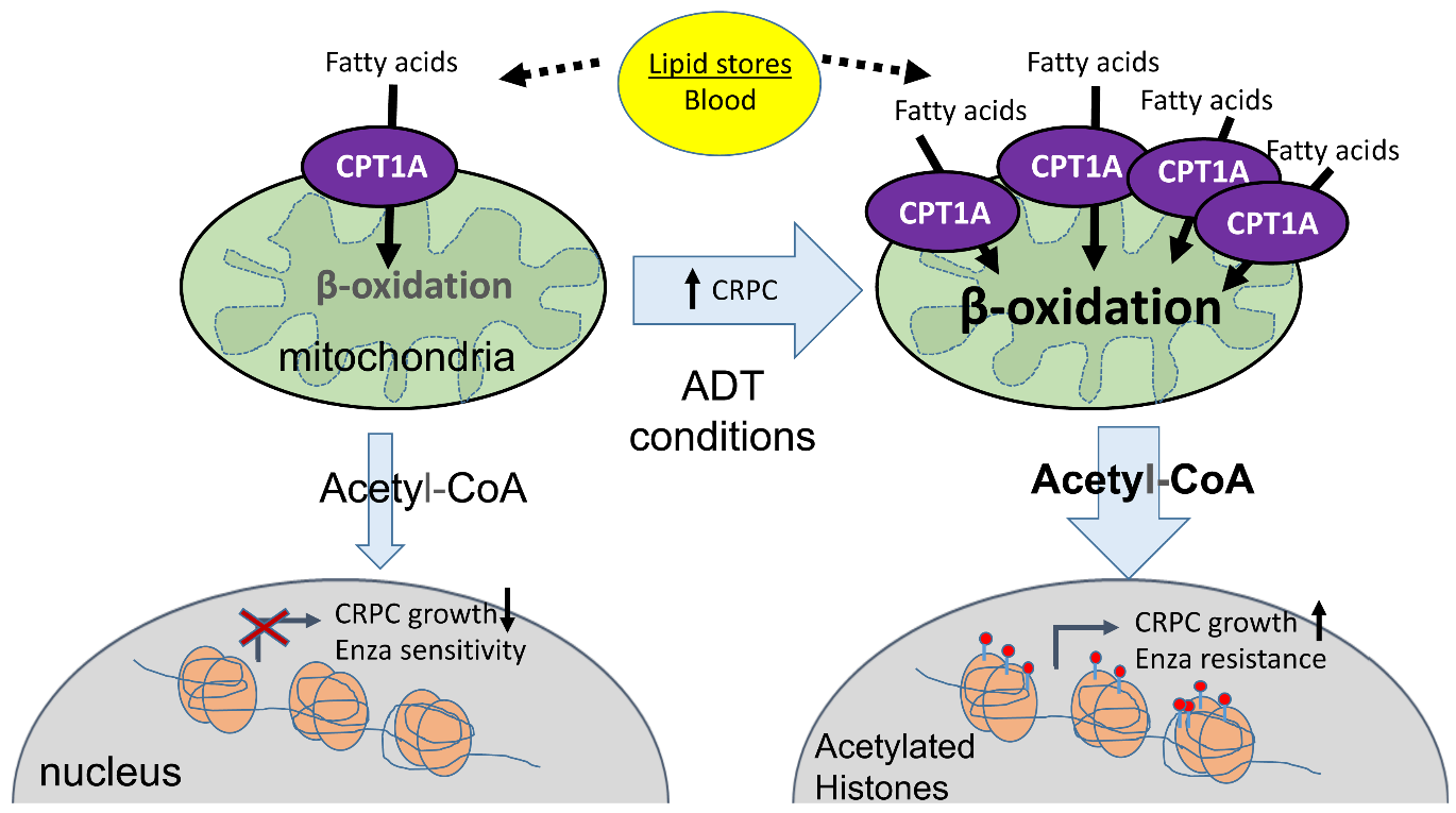 Cells | Free Full-Text | CPT1A Supports Castration-Resistant Prostate ...