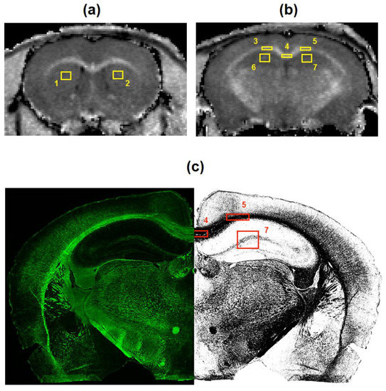 Quantitative Imaging of White and Gray Matter Remyelination in the ...